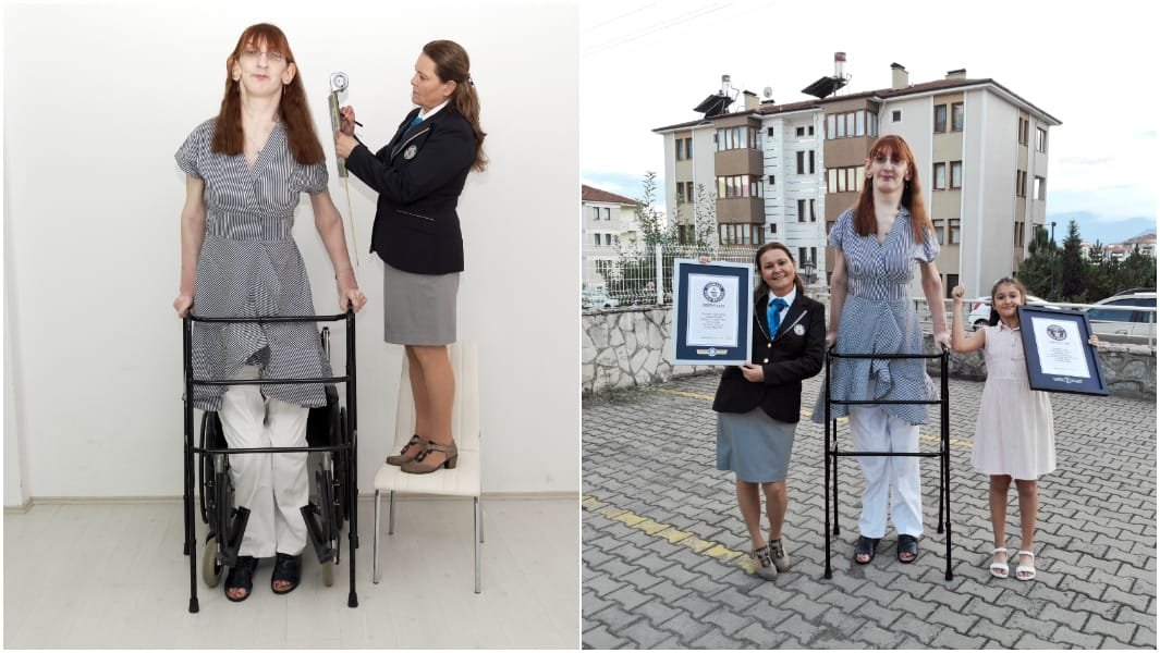 Turkey’s Rumeysa Marked As The World’s Tallest Woman By The Guinness ...